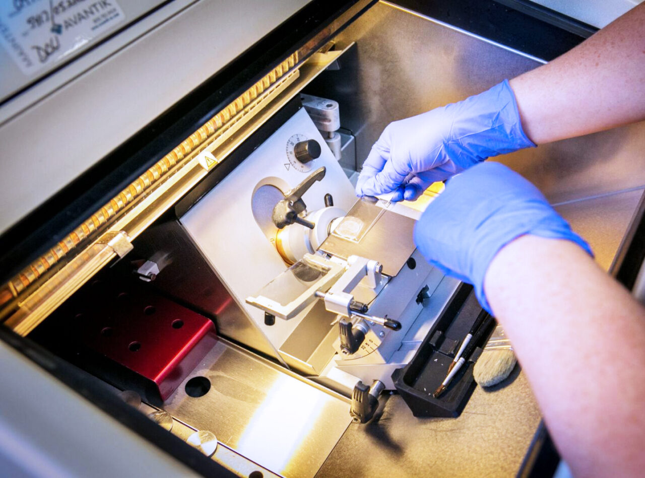 Mohs Micrographic Surgery | Dermatology Associates of Lancaster