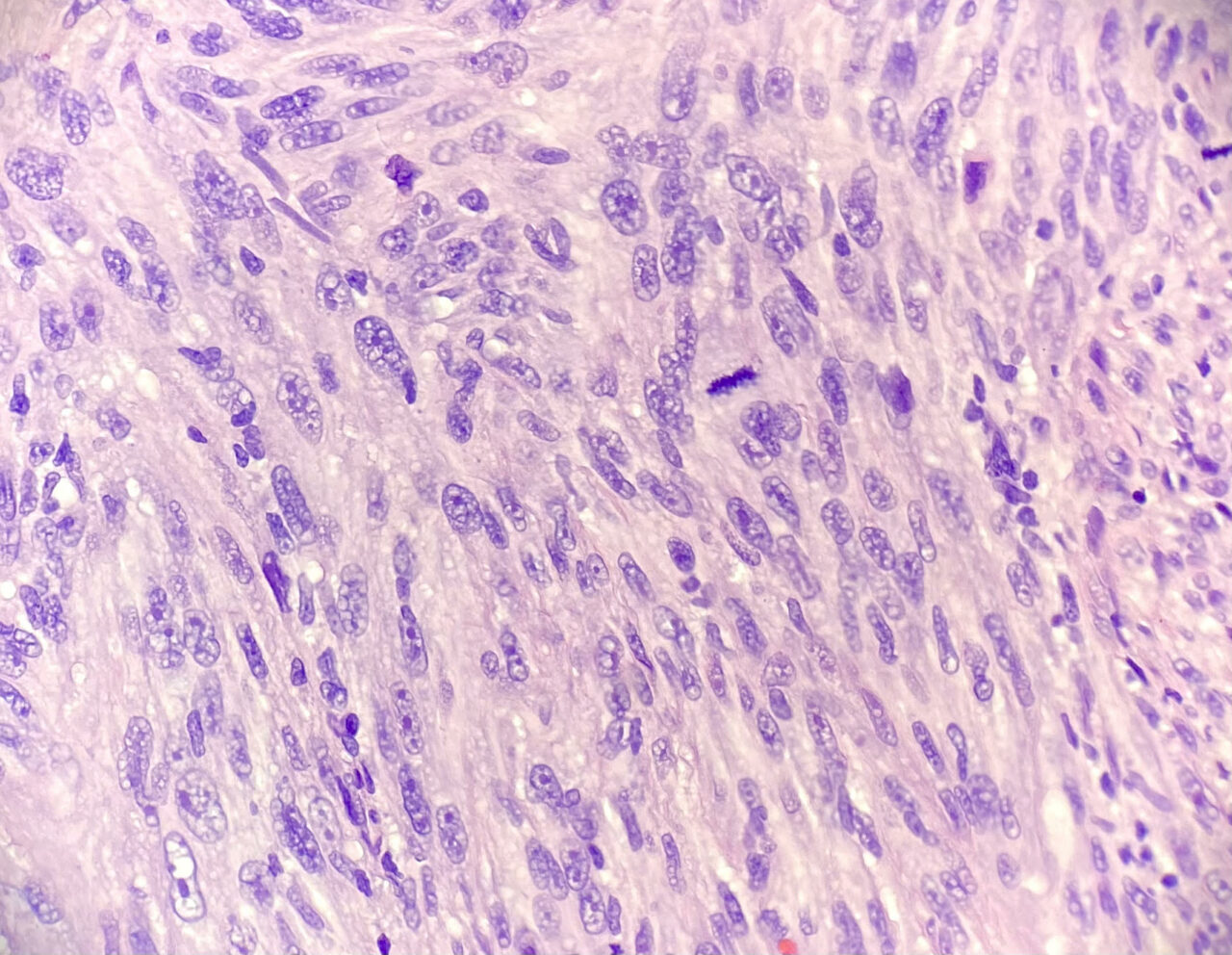 Dermatopathology | Dermatology Associates of Lancaster